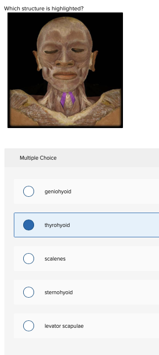 Solved Which structure is highlighted? Multiple Choice | Chegg.com