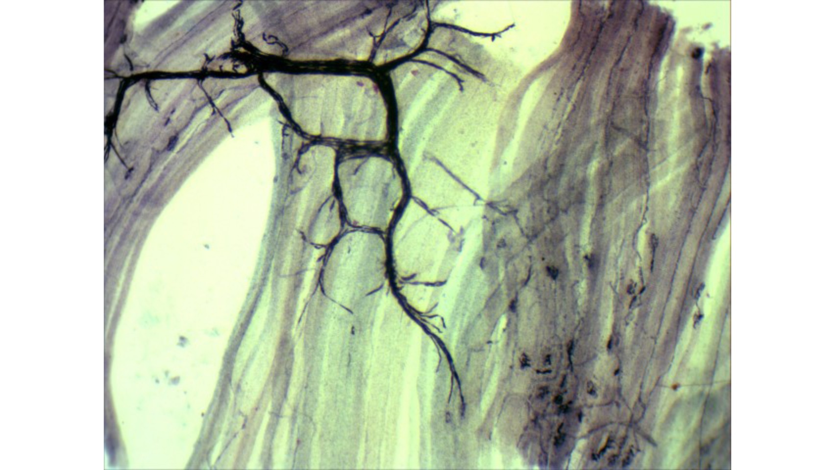 Solved what photo best shows the ends of an axon and the | Chegg.com
