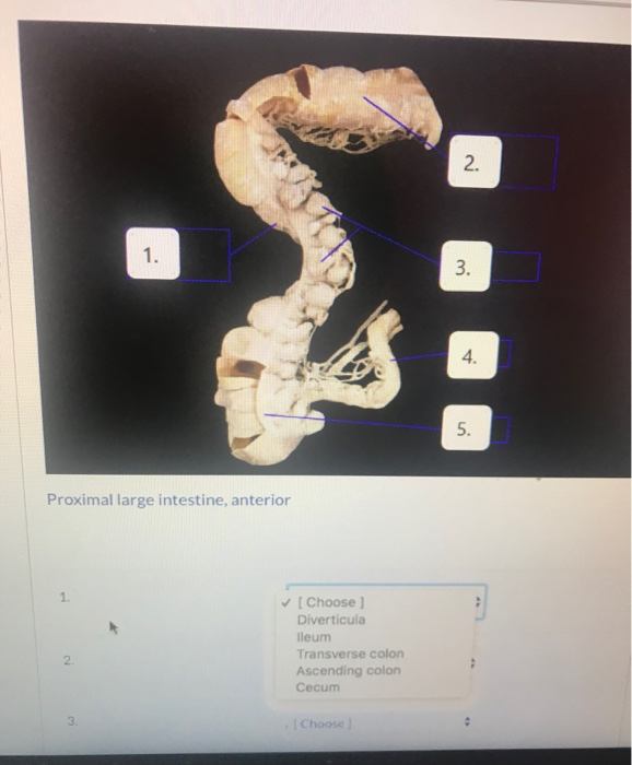 Solved Proximal large intestine, anterior [Choose ] | Chegg.com