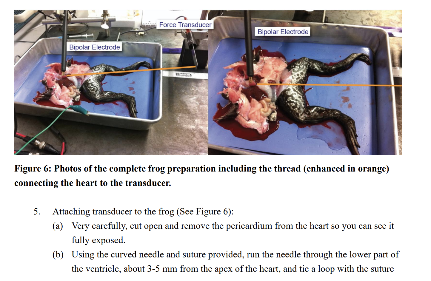 Solved Channel #1 Channel #2 ON OF 2 Filter Settings Gain | Chegg.com