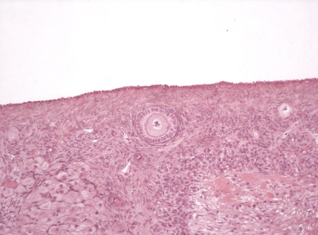 Solved Label the following structures ON BOTH PICTURES | Chegg.com