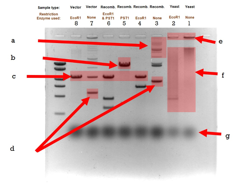 Solved Yeast DNA Size Markers Vector Vector Recomb. Recomb. | Chegg.com