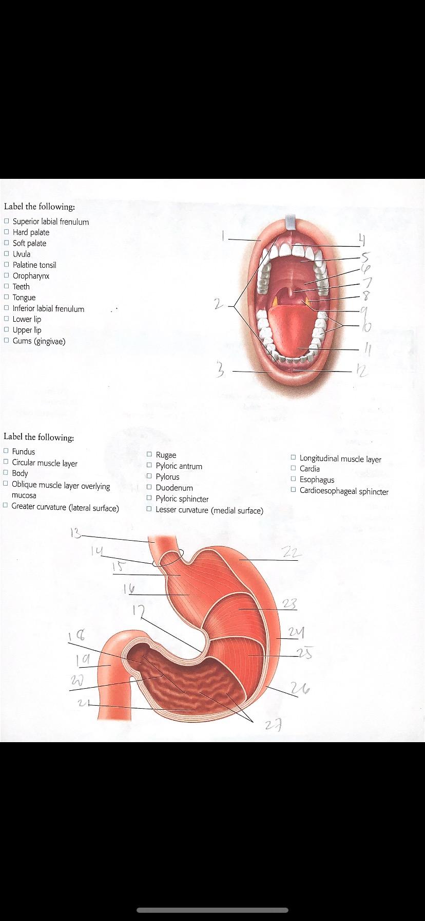 Solved Label the following: Superior labial frenulum Hard | Chegg.com