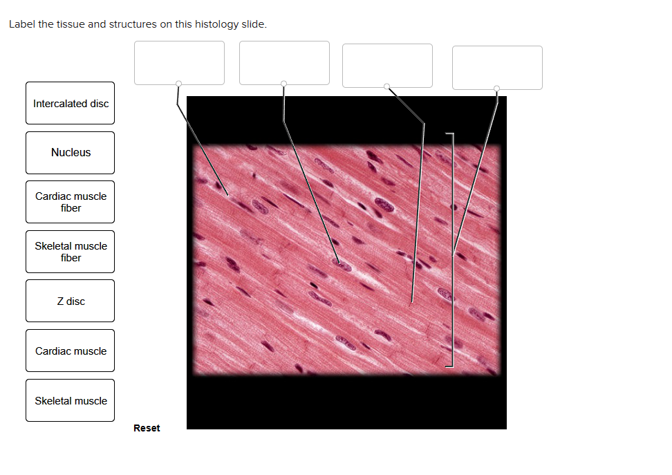 Solved Label the tissue and structures on this histology | Chegg.com