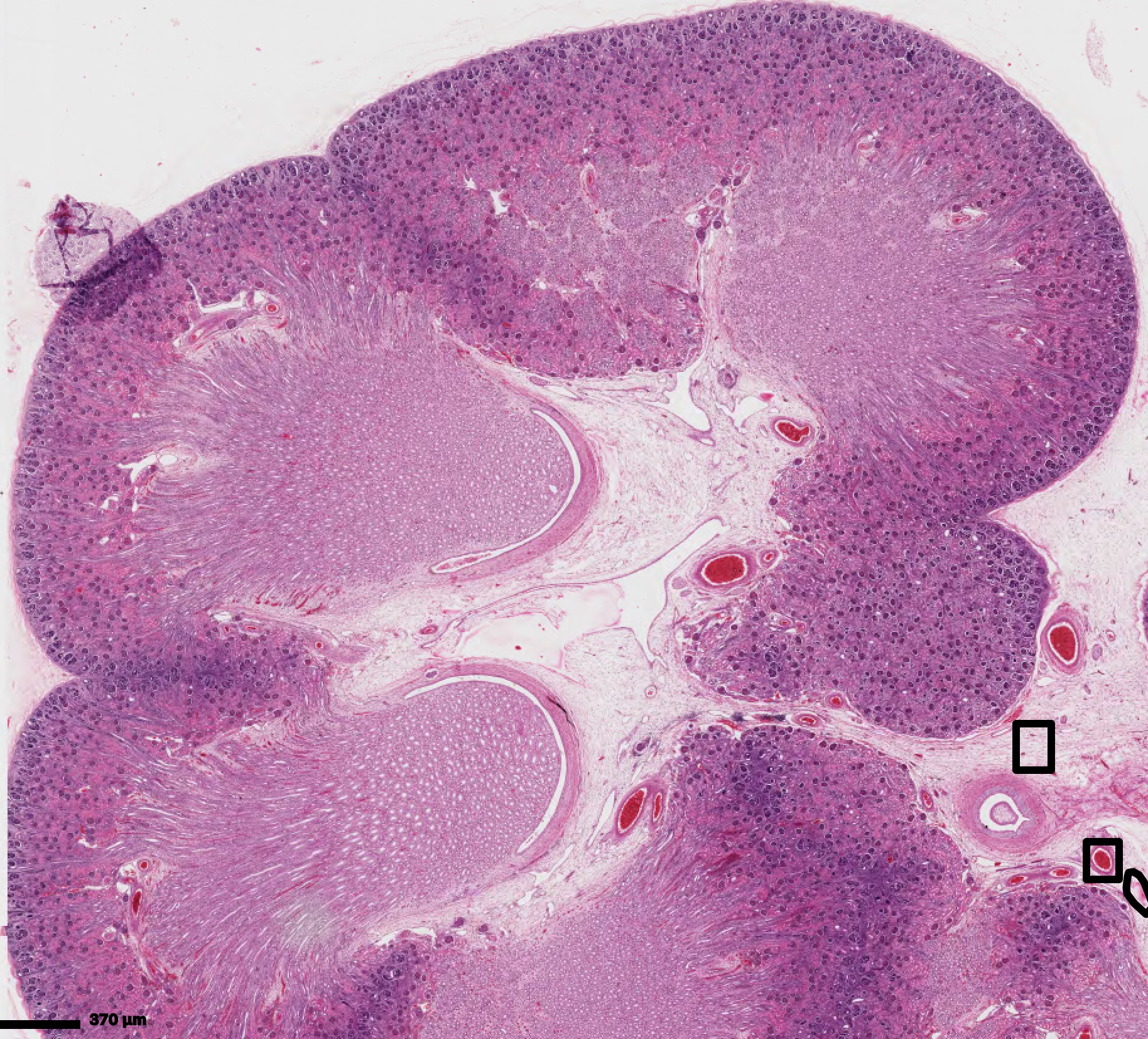 Solved I need help identifying an interlobar artery, | Chegg.com