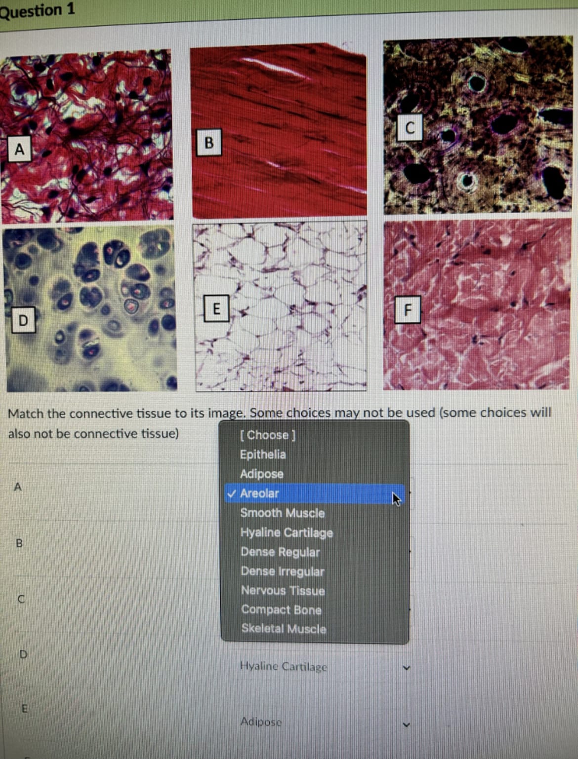 Solved Question 1Match the connective tissue to its image. | Chegg.com