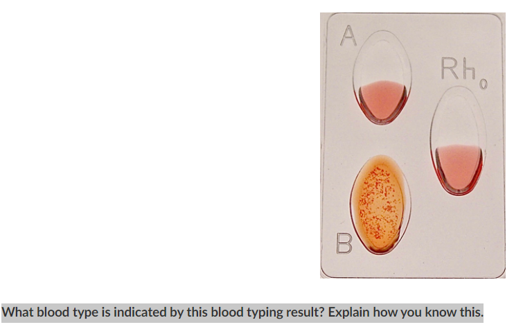 Solved A Rh What blood type is indicated by this blood | Chegg.com
