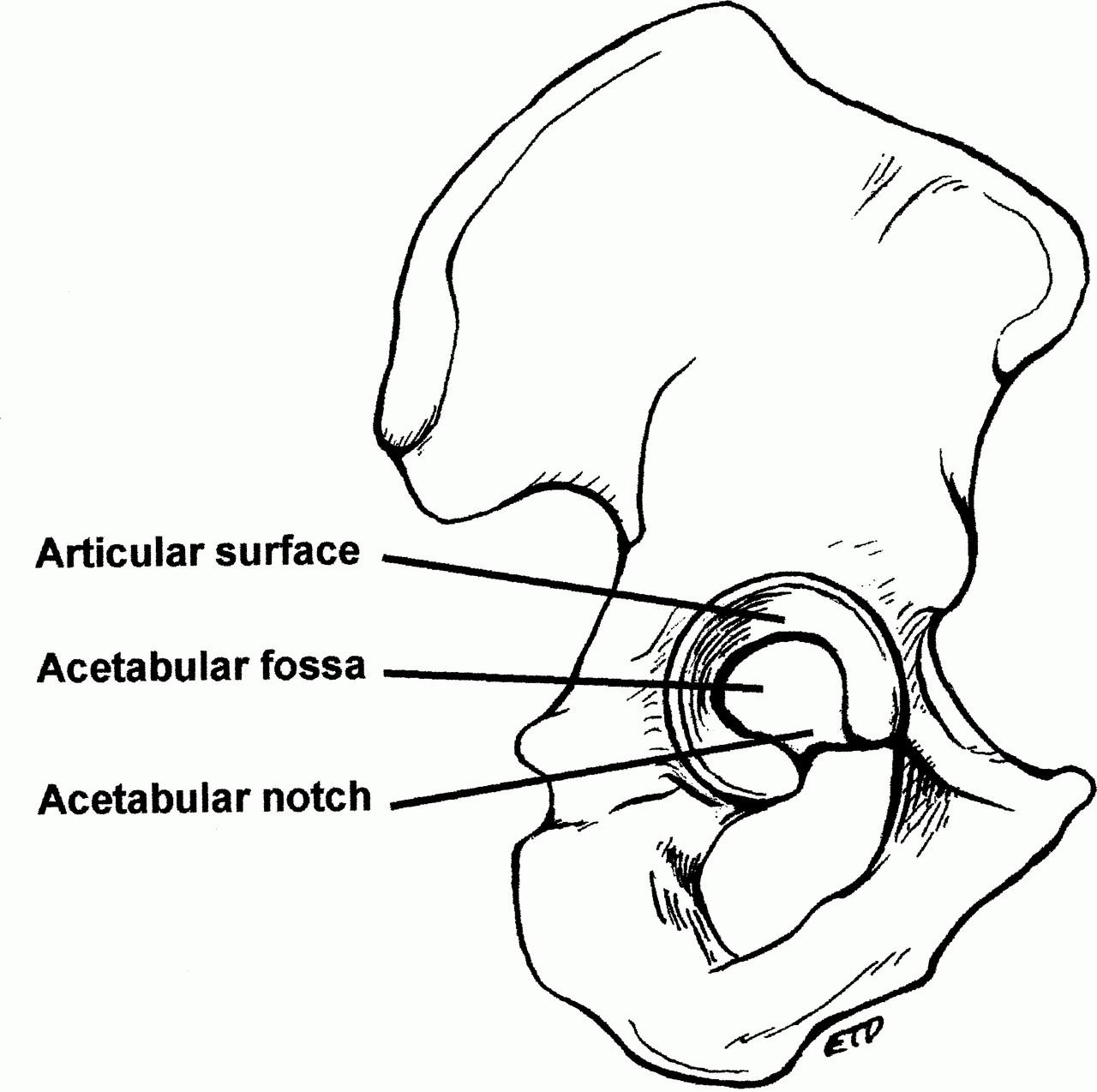 Acetabular Notch