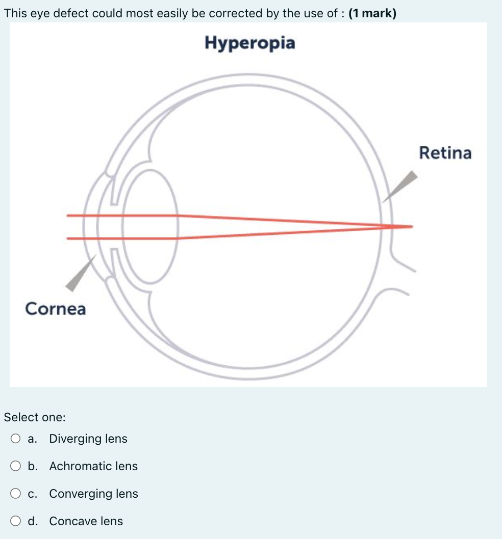 [Solved]: This eye defect could most easily be corrected b