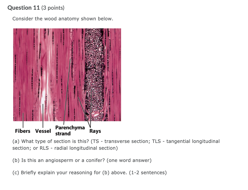 Solved Question 11 (3 points) Consider the wood anatomy | Chegg.com Solved Question 11 (3 points) Consider the wood anatomy | Chegg.com