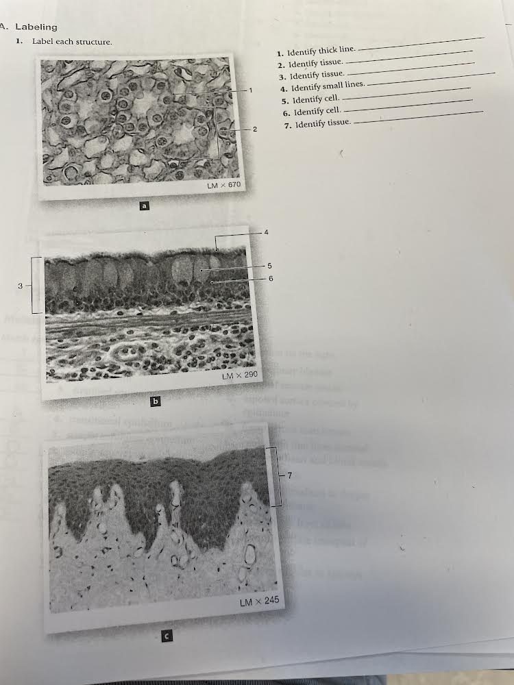 1. Label each structure. 1. Identify thick line 2. | Chegg.com