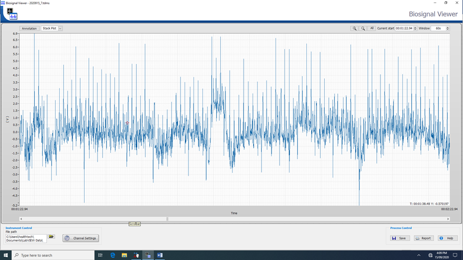 Solved Procedure National Instruments myDAQ is an relatively | Chegg.com