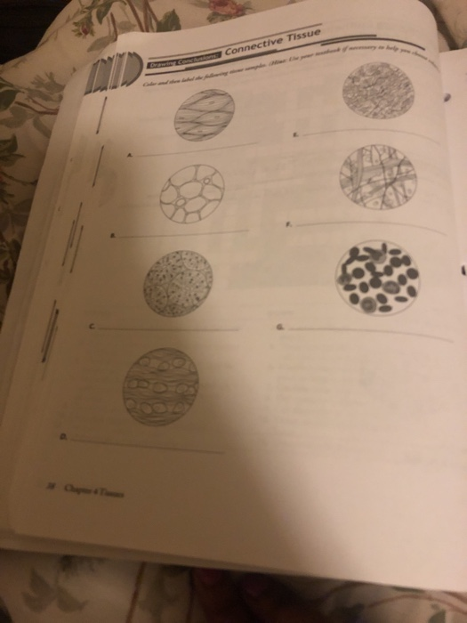 Connective Tissue Matrix Coloring Answers | Tobanga Colors