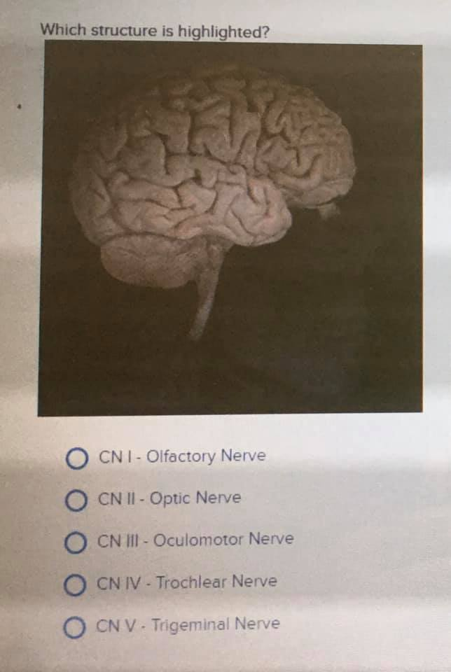 Solved Which structure is highlighted? OCNI - Olfactory | Chegg.com
