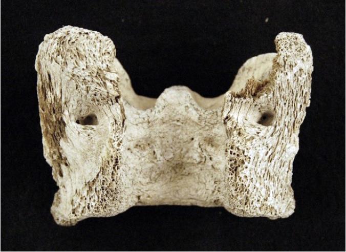 Solved WeatheringCase Scenario 1.Mountain climbers | Chegg.com