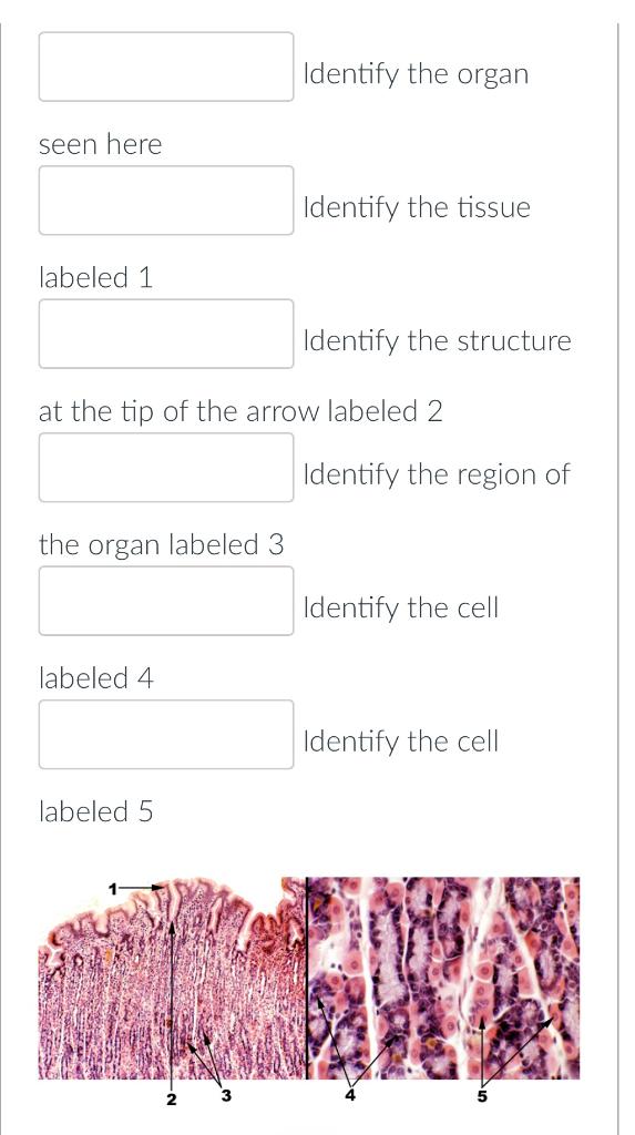 Solved Identify the organ seen here Identify the tissue | Chegg.com