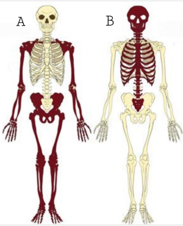 Solved Which sketeton has the axial skeleton shaded in dark | Chegg.com
