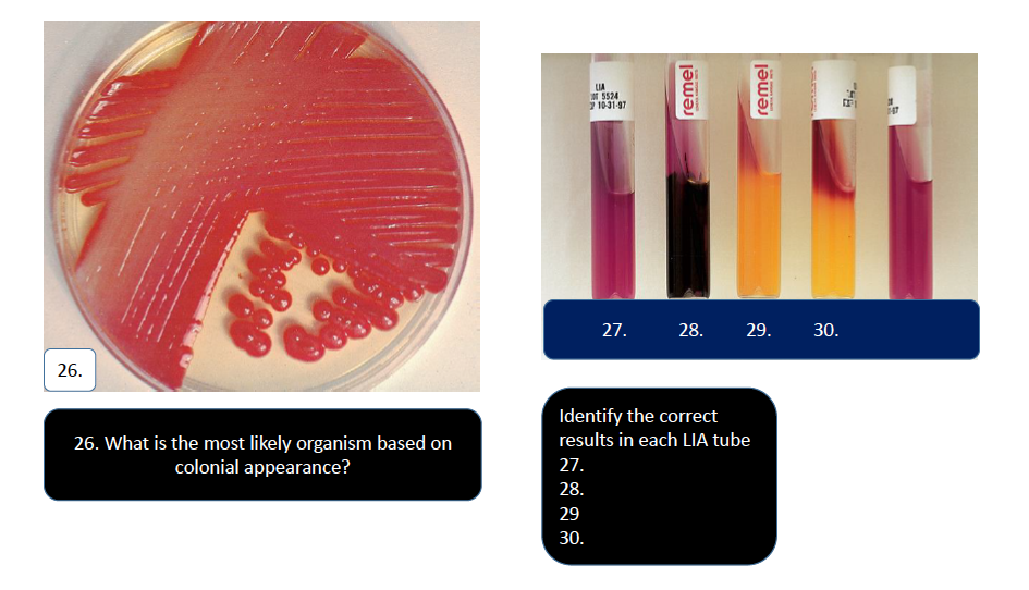 Solved LIA 5524 7 1031-97 27. 28. 29. 30. 26. 26. What is | Chegg.com