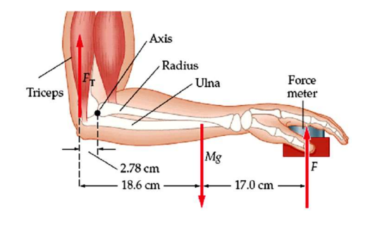 Solved Doctors use a force meter to determine the force of a | Chegg.com