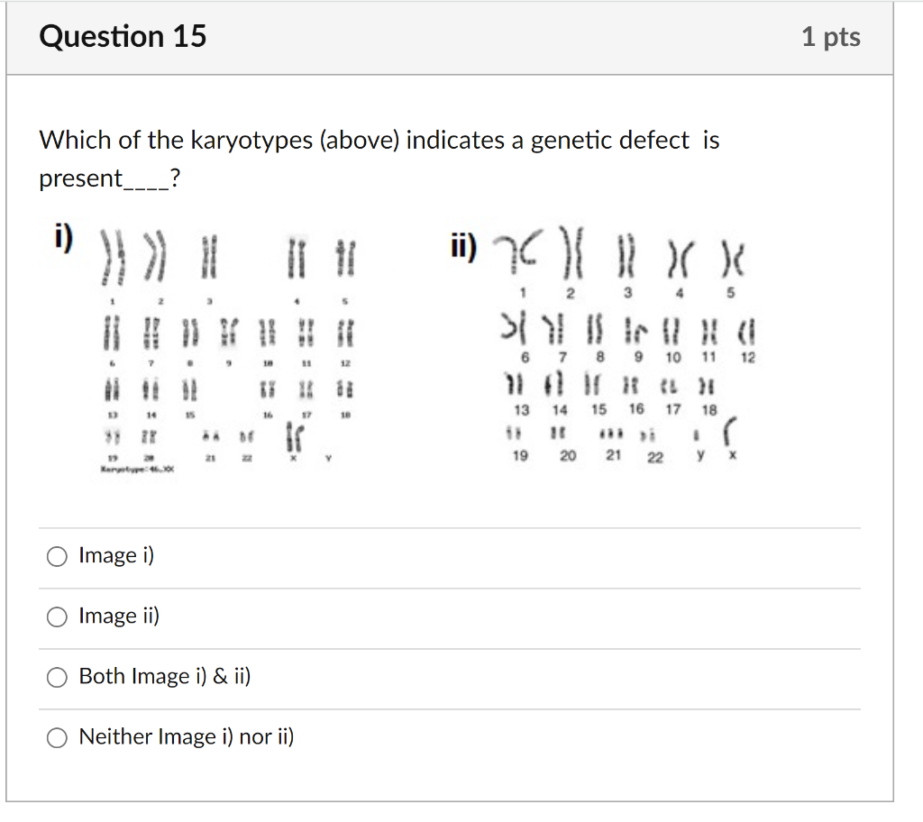 Solved Question 15 1 pts Which of the karyotypes (above) | Chegg.com