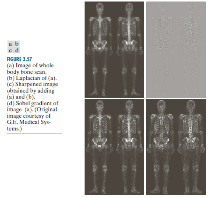 Solved a b cd FIGURE 3.57 (a) Image of whole body bone scan. | Chegg.com