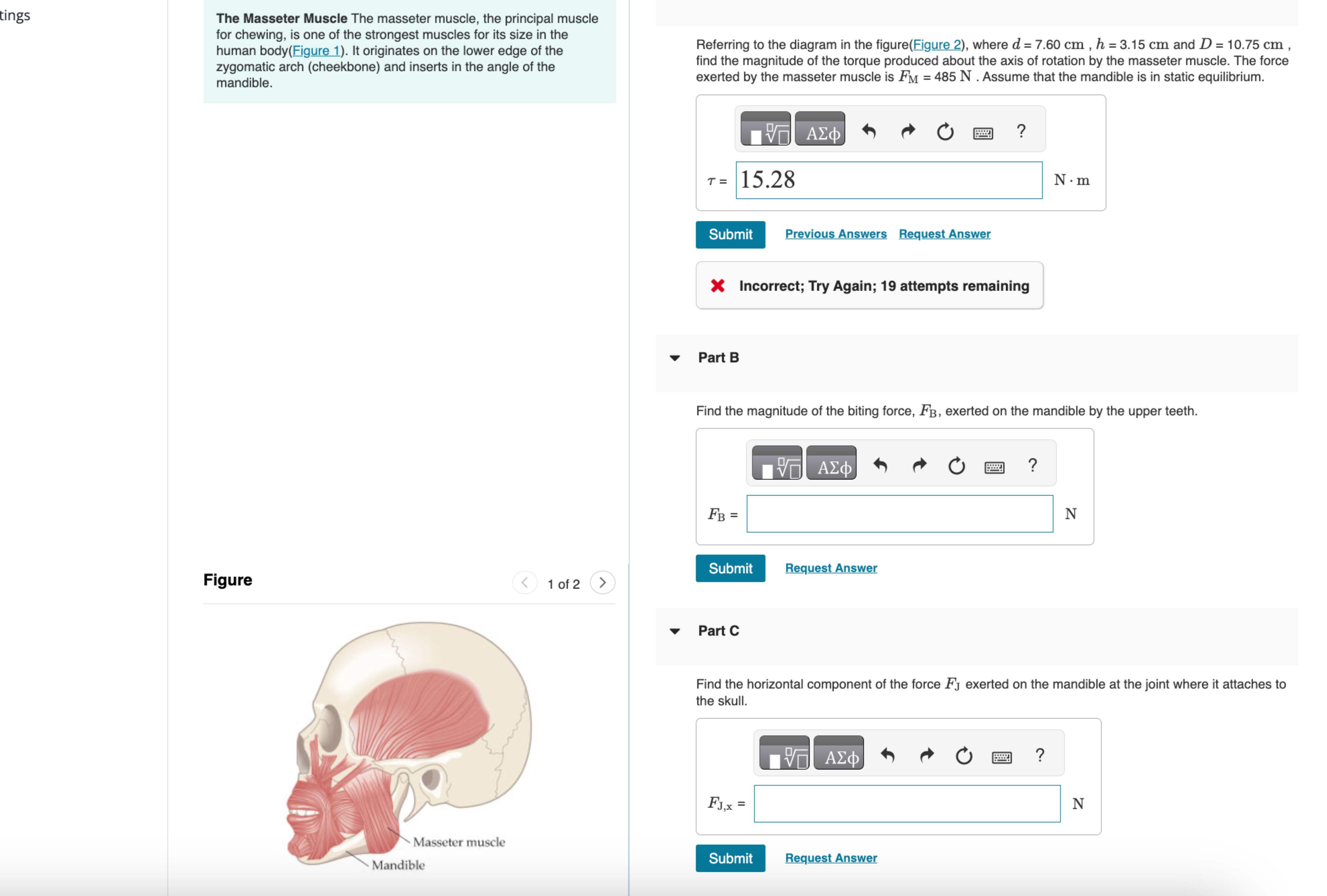 The Masseter Muscle The masseter muscle, the | Chegg.com