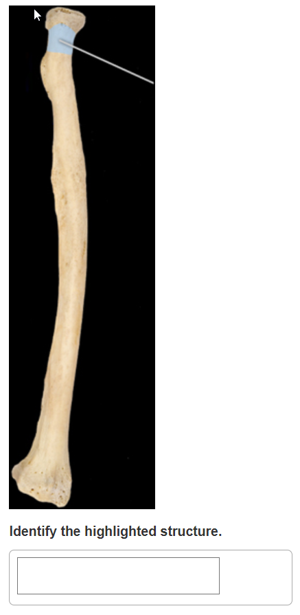 Solved Identify the highlighted structure. Identify A A B | Chegg.com