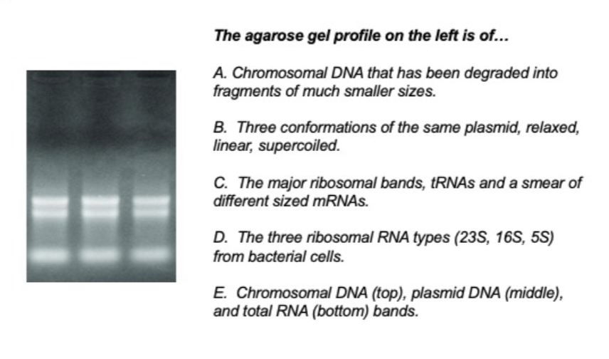Solved The agarose gel profile on the left is of... A. | Chegg.com