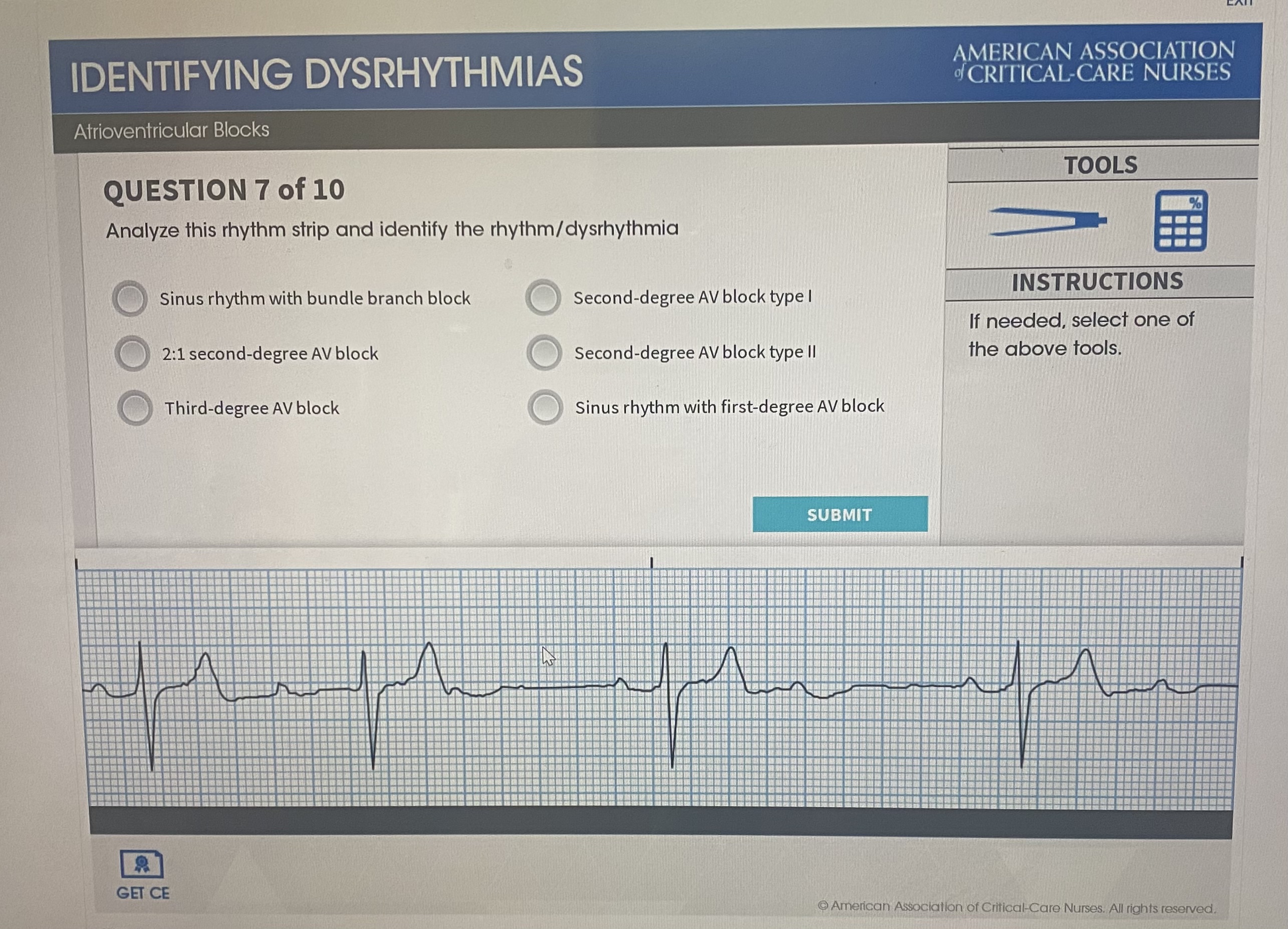 Analyze this rhythm strip and identify the | Chegg.com