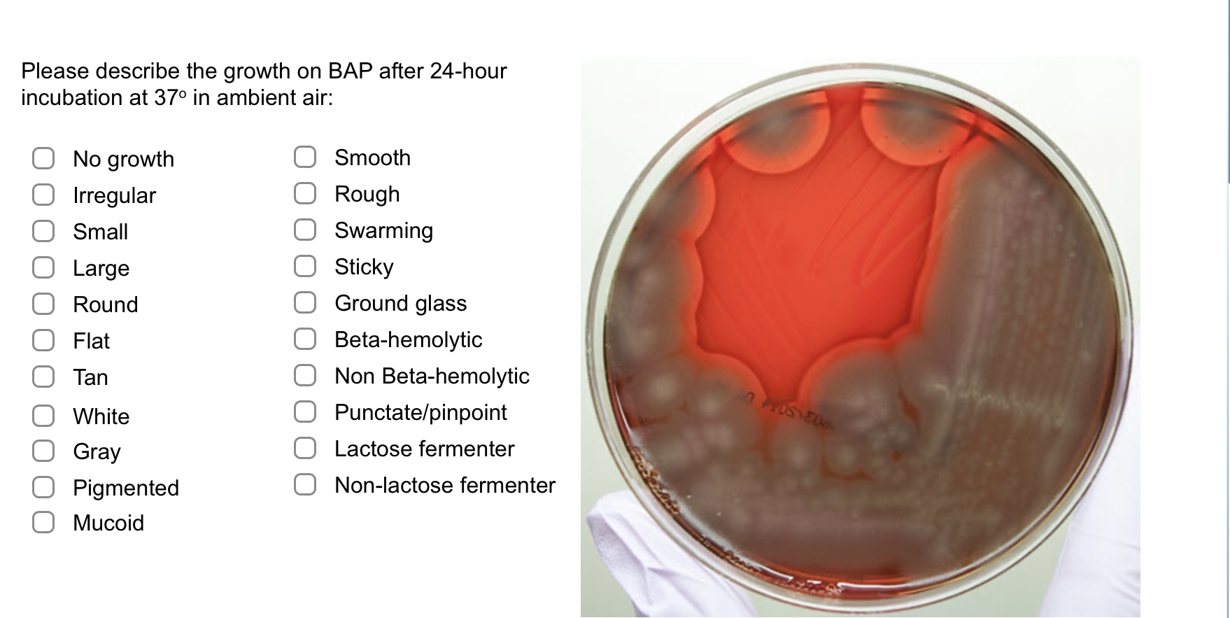 Solved Please describe the growth on BAP after 24-hour | Chegg.com