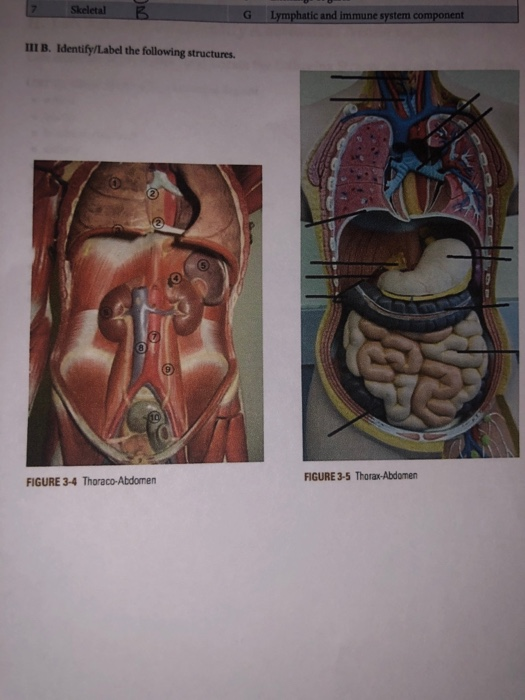 Solved ic and immune III B. Identify/Label the following | Chegg.com