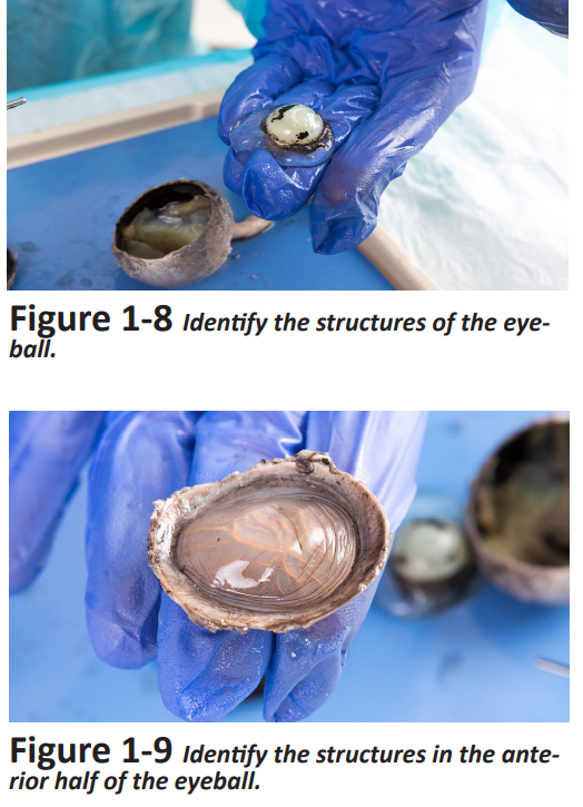 Solved Figure 1-8 Identify the structures of the eye- ball. | Chegg.com