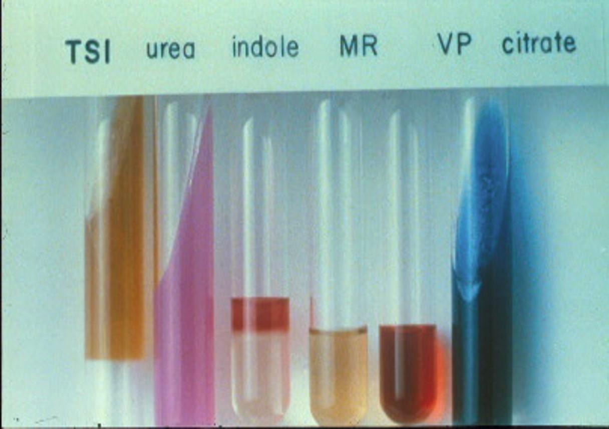 Solved TSI urea indole MR VP citrate | Chegg.com