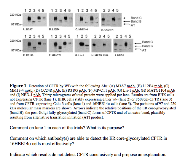 Solved 1 2 34 5 1 2 345 1 2 3 45 2 345 220 KDa Band C Band B | Chegg.com