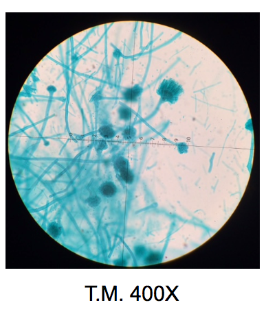 Penicillium Under Microscope 400x