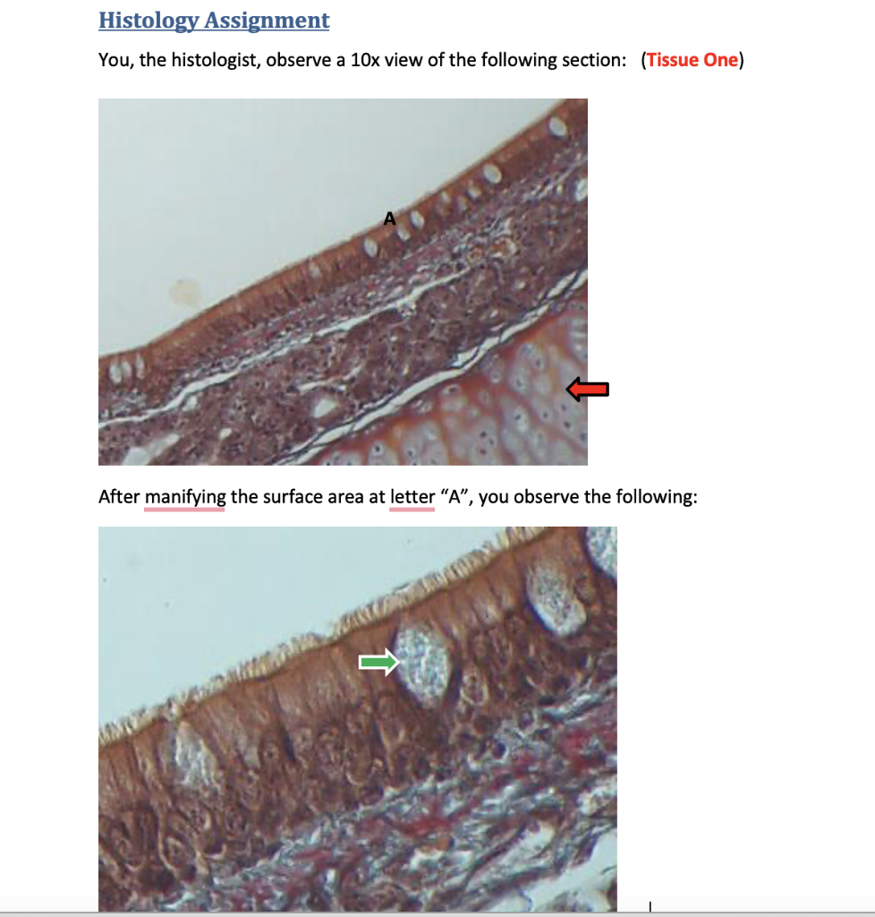 Solved Histology Assignment You, the histologist, observe a | Chegg.com Solved Histology Assignment You, the histologist, observe a | Chegg.com