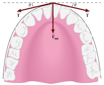 Solved What force is exerted on the tooth in the figure | Chegg.com