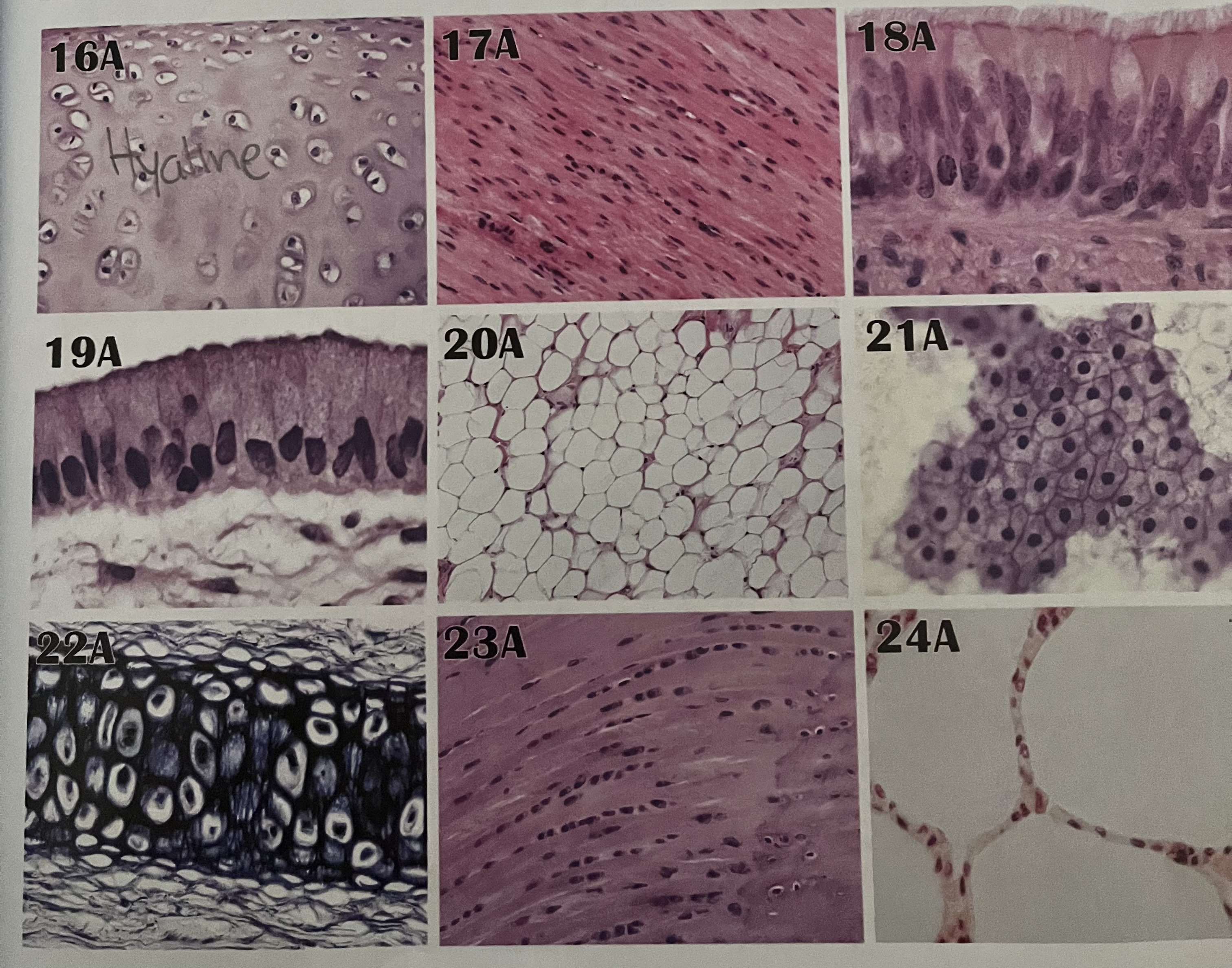 Solved 16-32: Word bank Column A - Stratified squamous | Chegg.com
