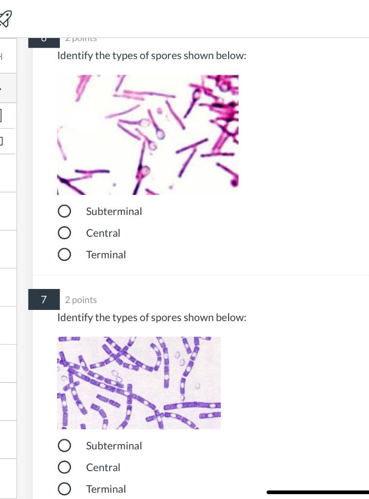 Solved 2 POITTES -1 Identify the types of spores shown | Chegg.com