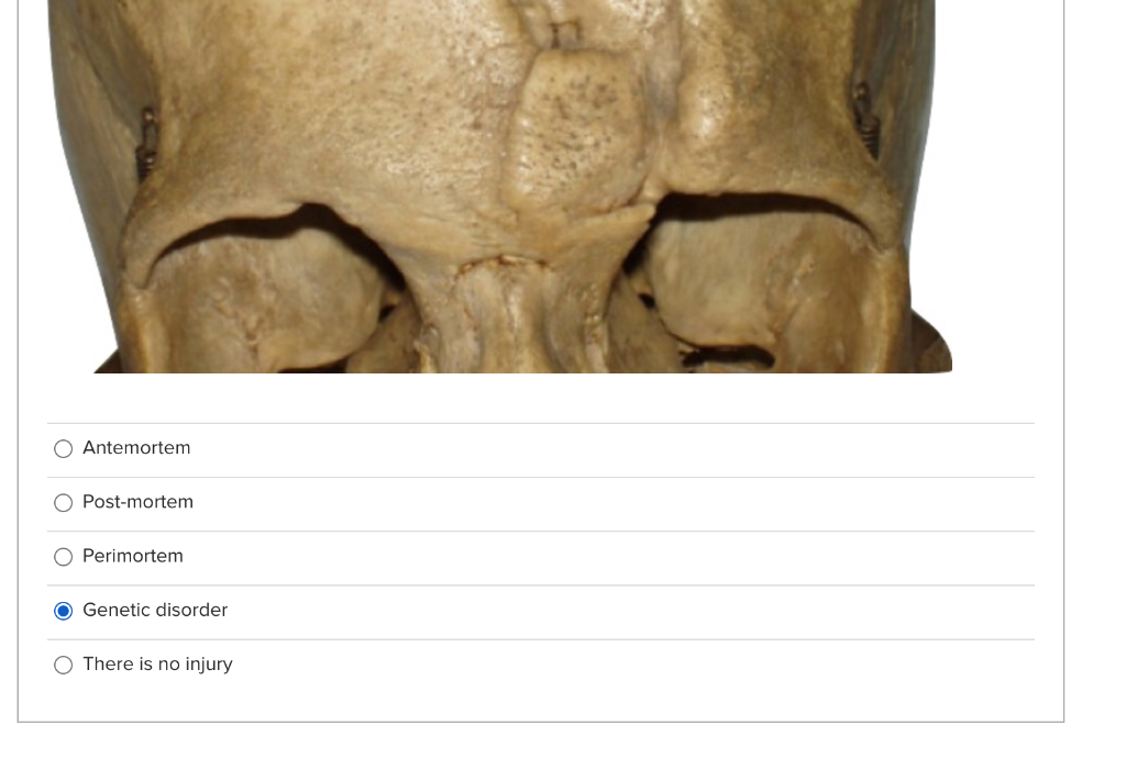When did this injury occur? Antemortem Post-mortem | Chegg.com