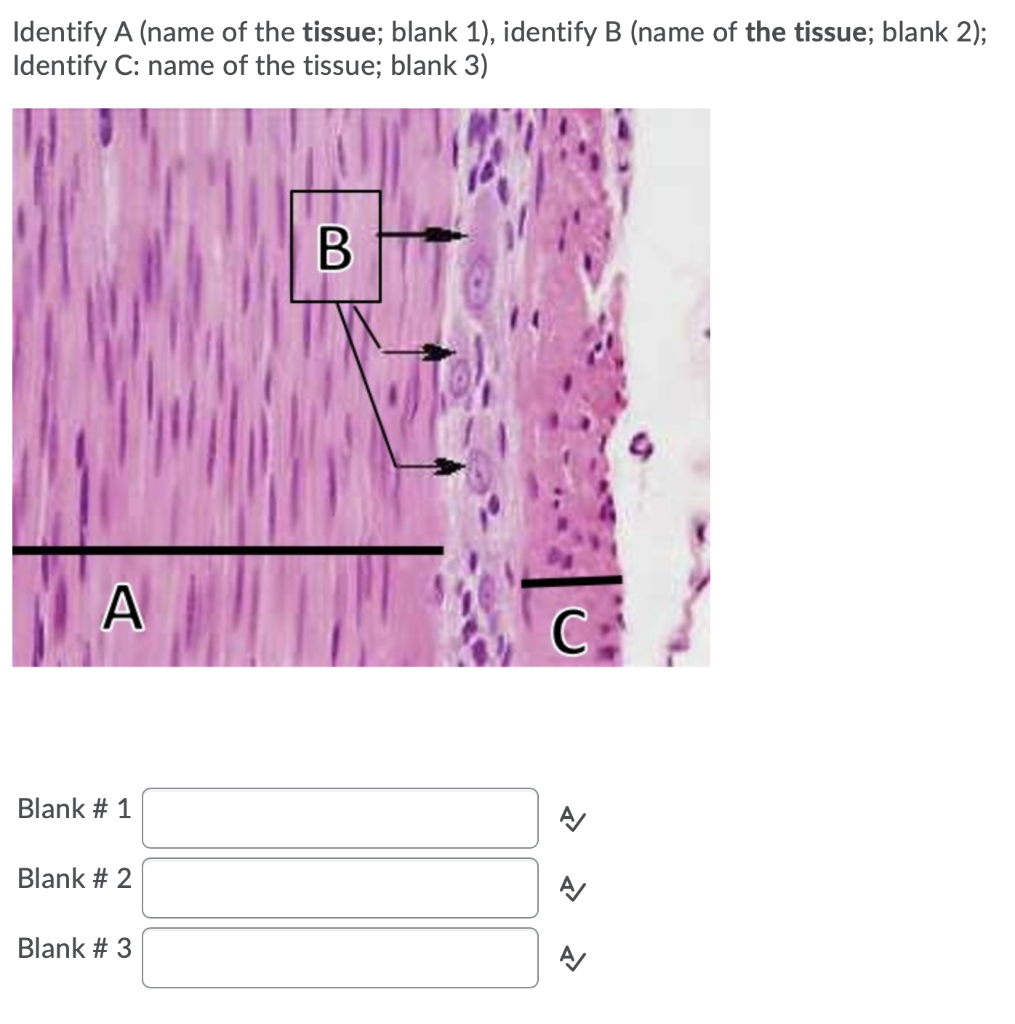 Solved Identify A (name of the tissue; blank 1), identify B | Chegg.com