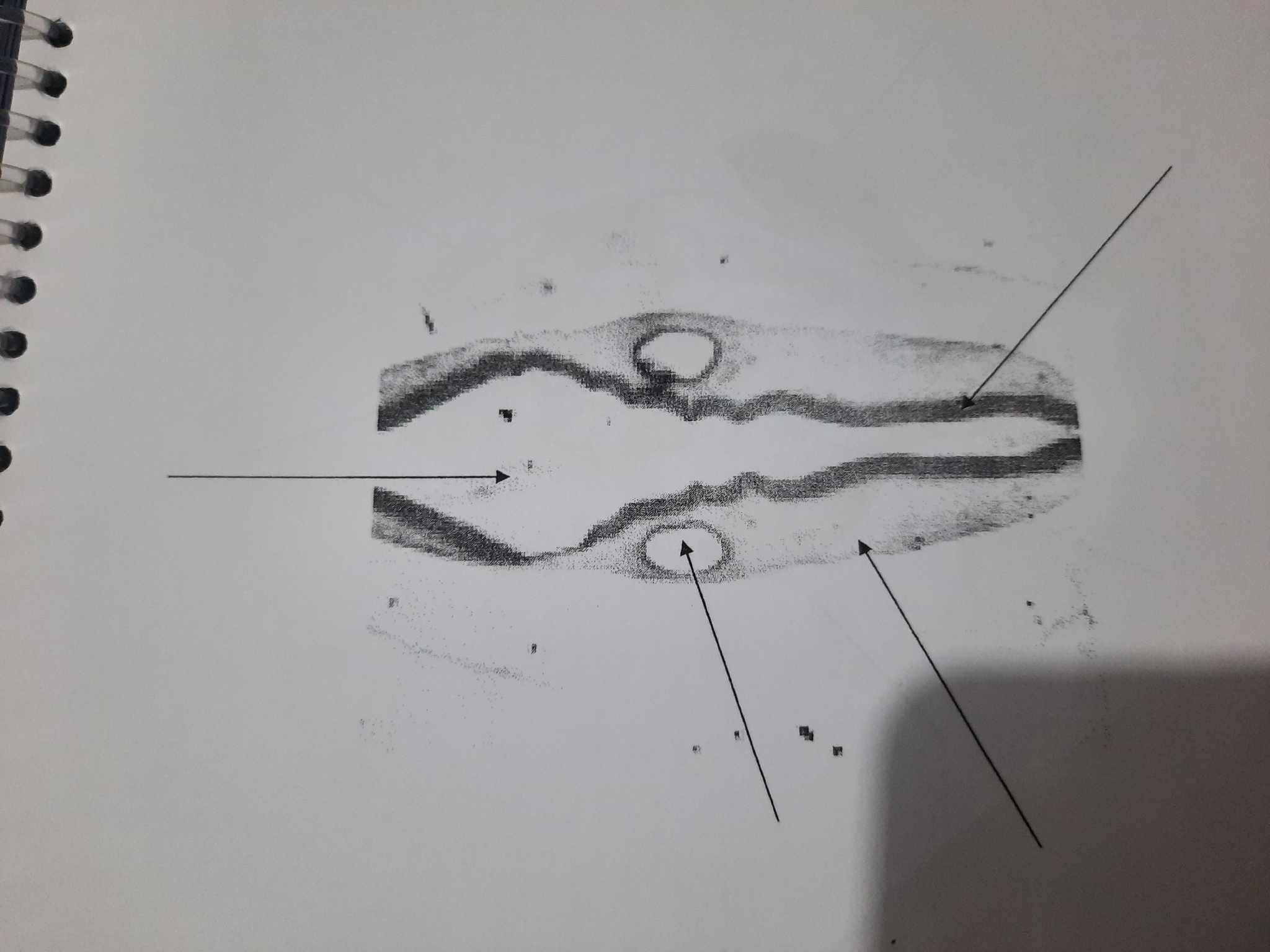 Solved B. At the level of the liver. Identify / Label the | Chegg.com