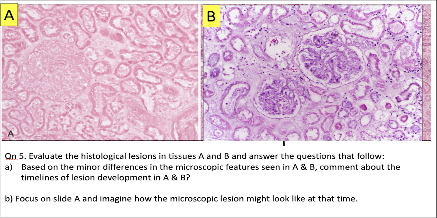 Solved A B A Qn 5. Evaluate the histological lesions in | Chegg.com