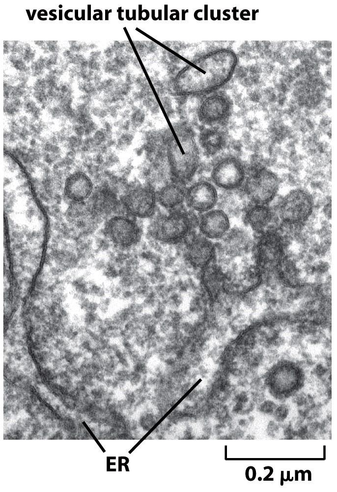 Solved 6. What are the vesicular tubular clusters? How are | Chegg.com