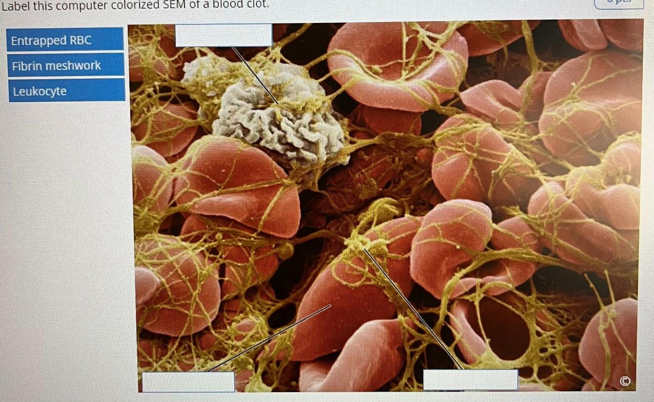 Label this computer colorized SEM of a blood clot. | Chegg.com