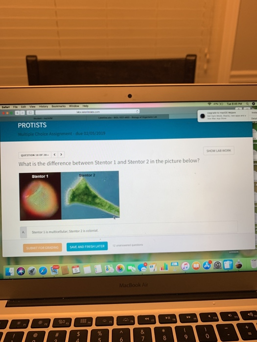 What is the difference between Stentor 1 and Stentor | Chegg.com