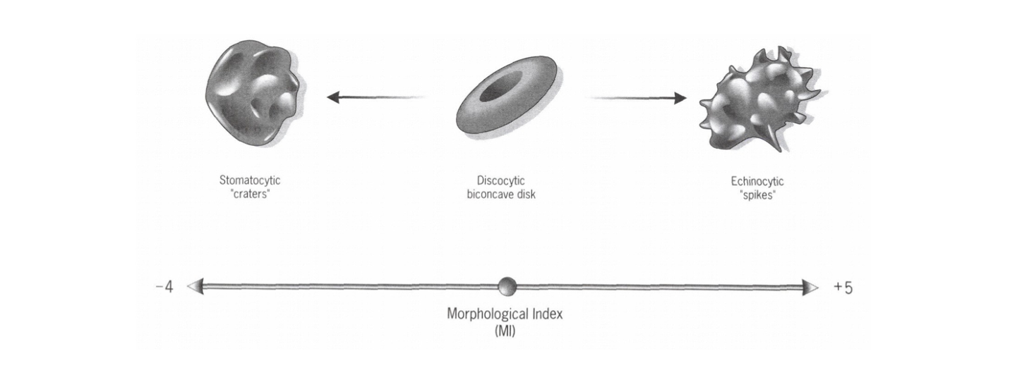Please Answer Questions 1-6. Case 13- A “Flippase” | Chegg.com