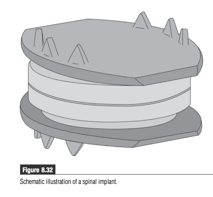 Solved Consider an artificial disk replacement for use in | Chegg.com