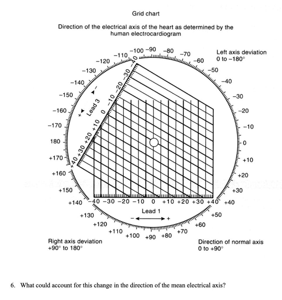 5. The above ECGs were recorded from the same | Chegg.com