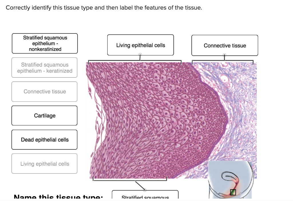 Solved Vlew previous atten Simple Simple squamous | Chegg.com